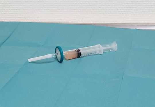 CST-behandling | Serumbehandling af inflammatoriske sygdomme